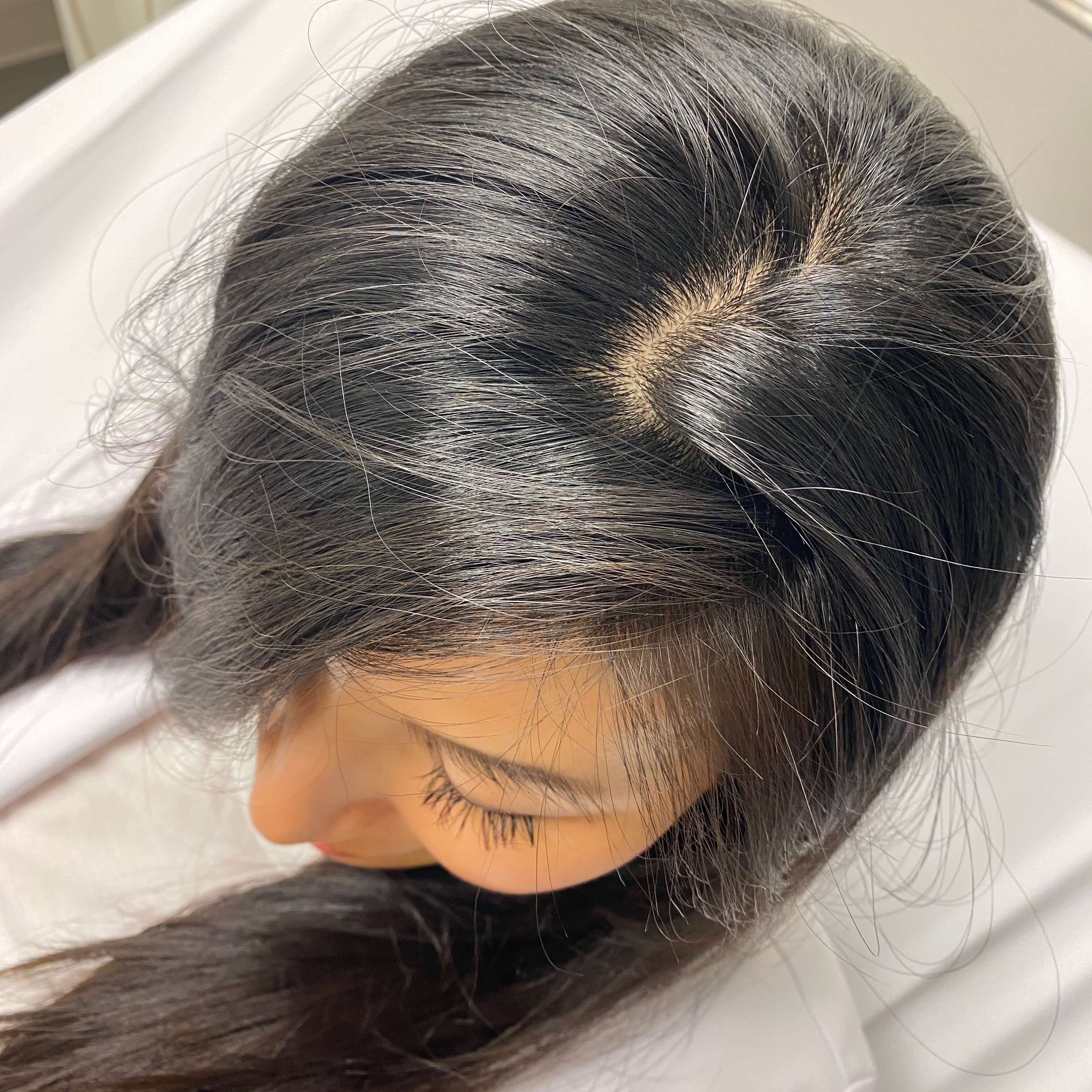 SERVICES – Flora Kim Dermatology